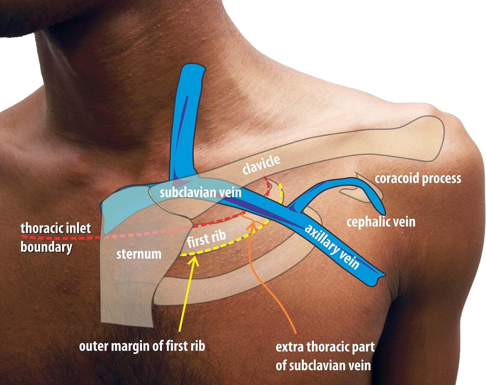 Left Subclavian Vein Anatomy Left Subclavian Vein Anatomy
