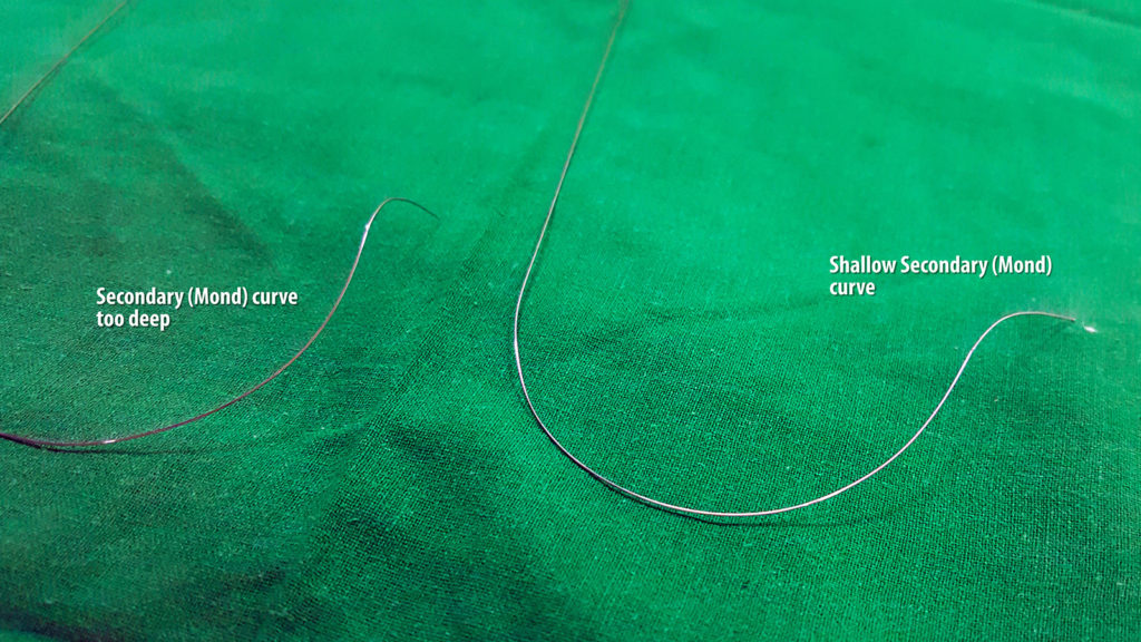 Septal Implantation of Right Ventricular Lead – How to Pace