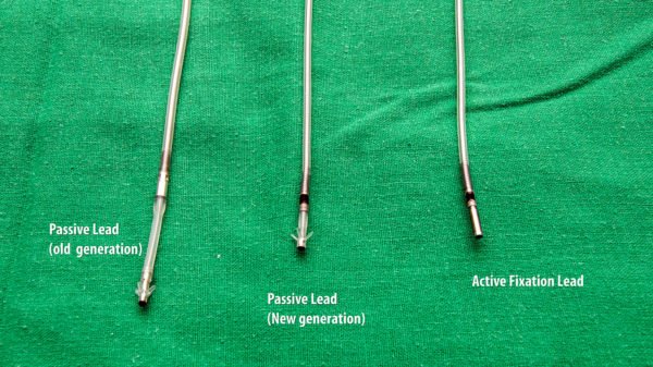 Basics of Pacing Leads – How to Pace
